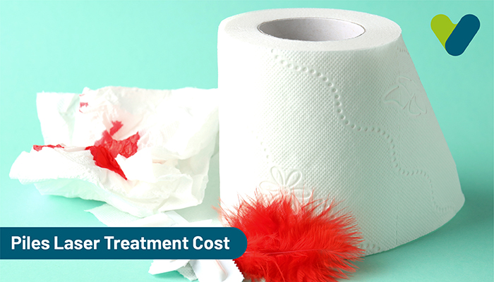 Piles Operation Cost: Know Piles Laser Treatment Cost In India
